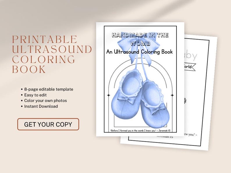 Printable Ultrasound Coloring Book | Christian Pregnancy Keepsake ...