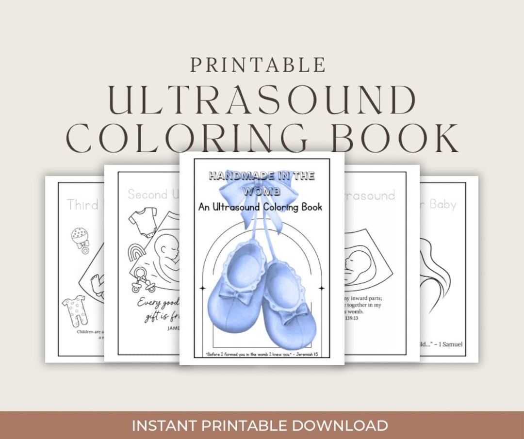 Printable Ultrasound Coloring Book | Christian Pregnancy Keepsake ...