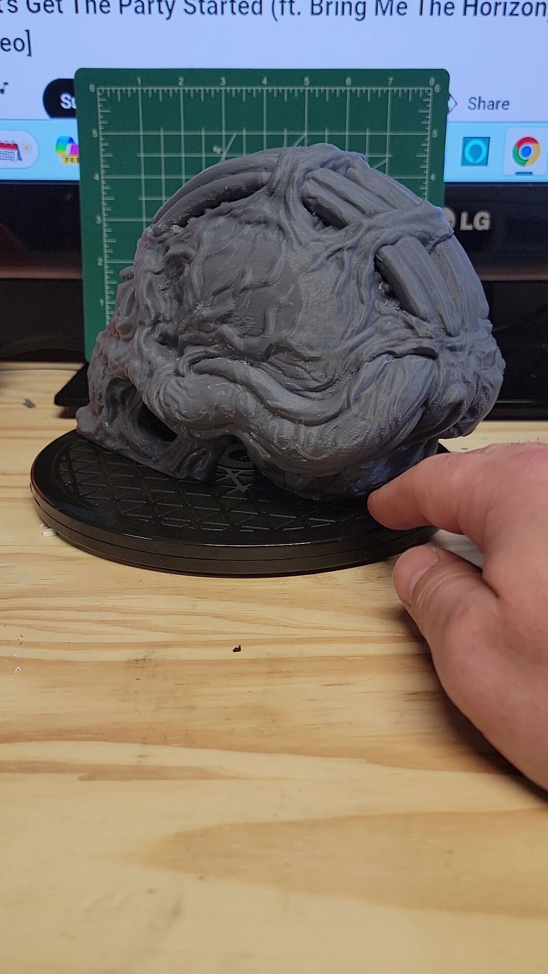 3d Printed Modified Brain Hemorrhage Skull - Etsy