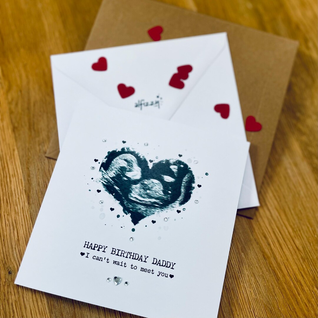Personalized Baby Scan Photo Card: Handmade Keepsake Announcement - Etsy UK