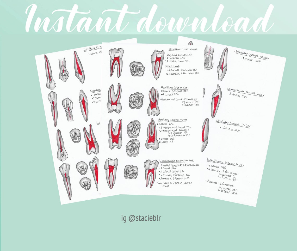 Endodontic Access Diagrams Root Canal Therapy for Endodontics - Etsy