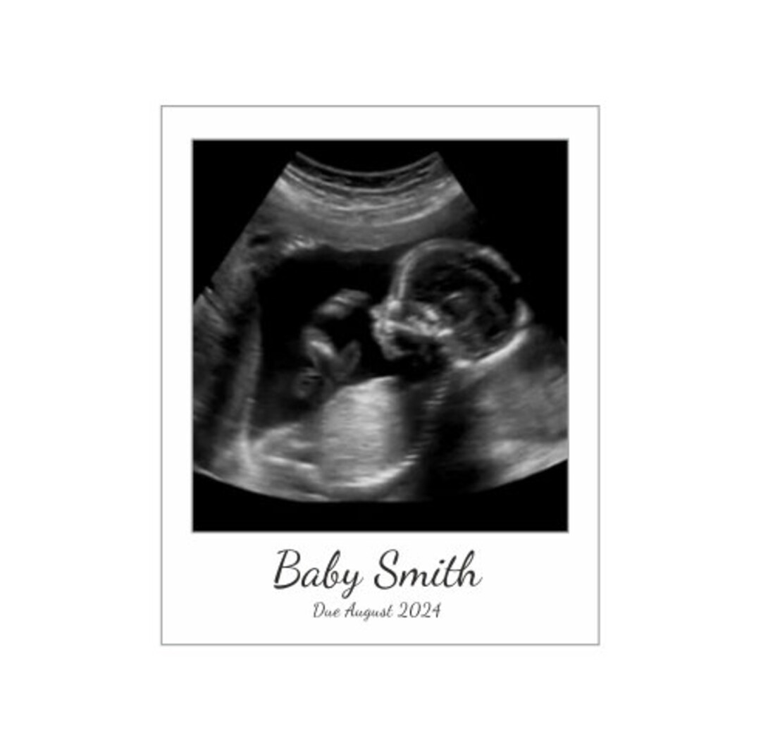 Baby Scan Polaroid Cupcake Toppers Personalised Cupcake Toppers Edible ...