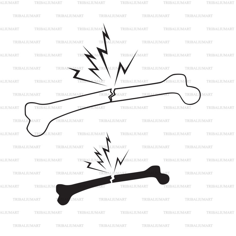 Broken Bone Svg - Etsy