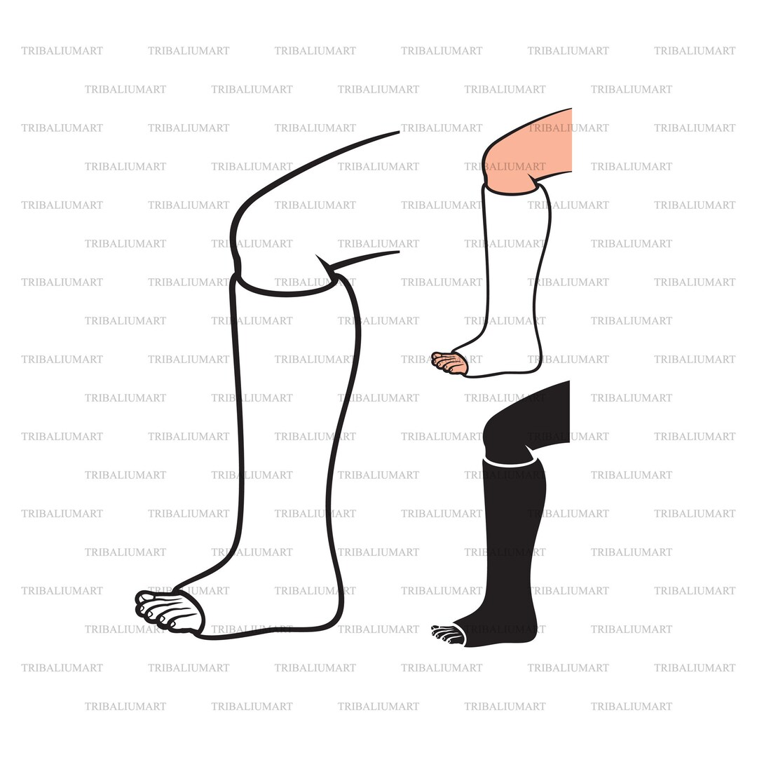 Broken Human Leg in Bandage (cast). Cut Files for Cricut. Clip Art ...
