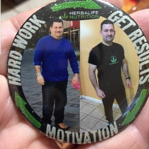 Before and After Buttons - Etsy