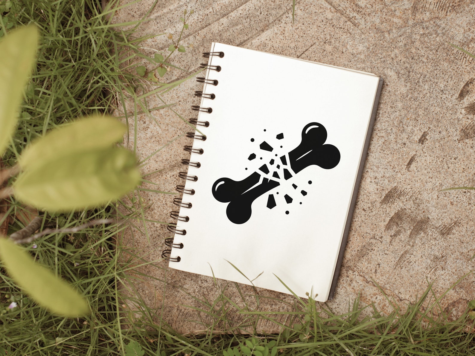Broken Bone SVG - Shattered Bone Fracture Skeleton Injury Printable ...