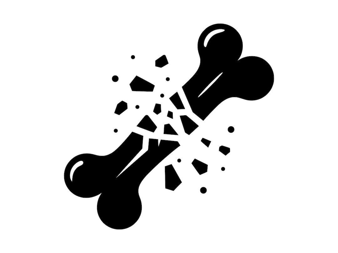 Broken Bone SVG - Shattered Bone Fracture Skeleton Injury Printable ...