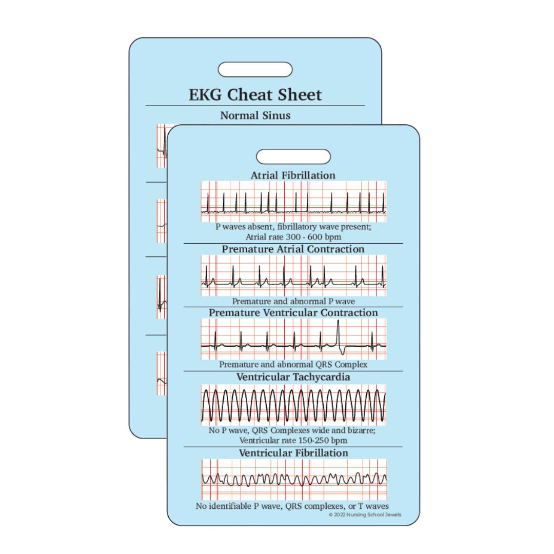 EKG Cheatsheet EKG Interpretation Reference Card Dysrhythmia Badge ...