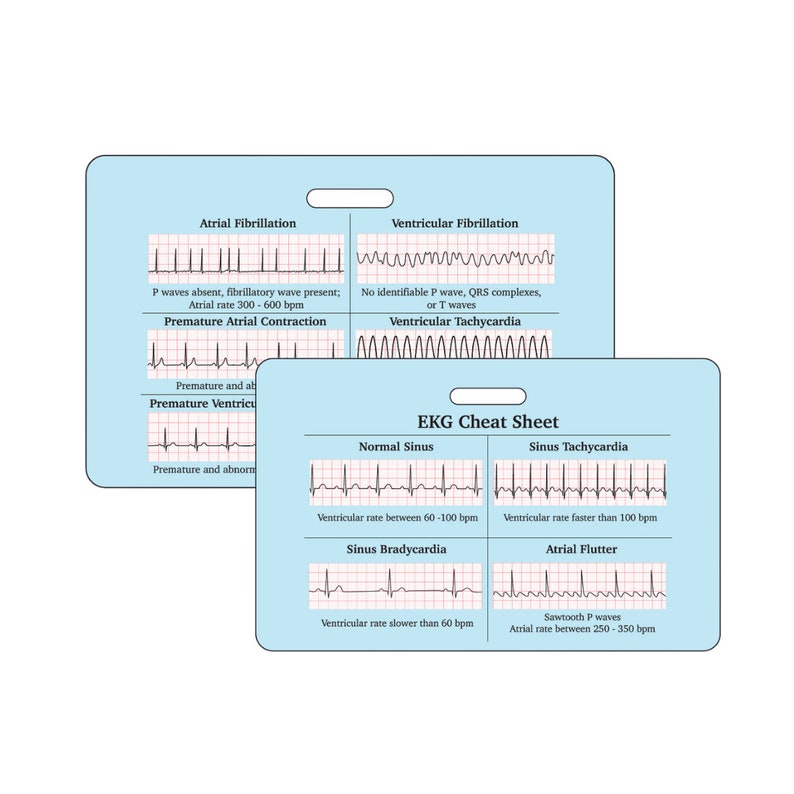 EKG Cheatsheet EKG Interpretation Reference Card - Etsy