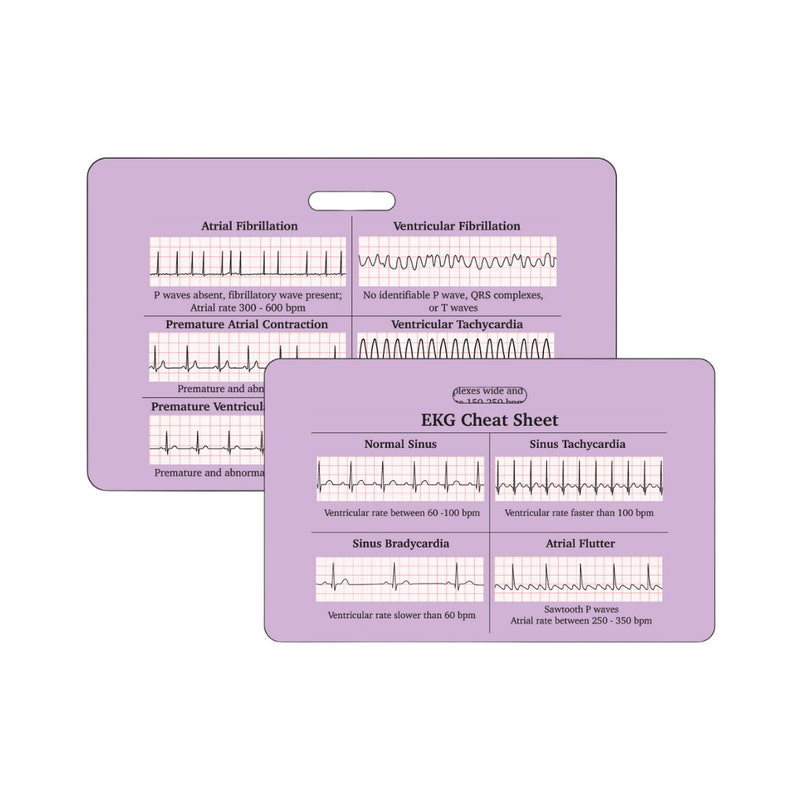 EKG Cheatsheet EKG Interpretation Reference Card - Etsy