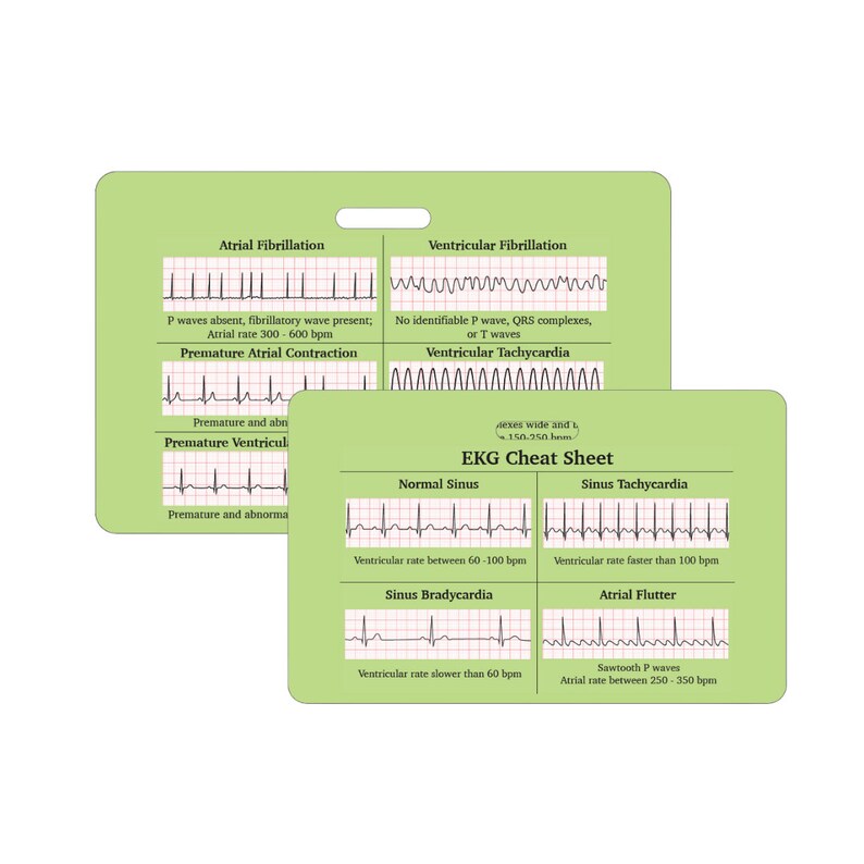 EKG Cheatsheet EKG Interpretation Reference Card - Etsy