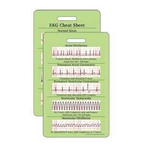 EKG Nursing Reference Cards | Nursing Badge Cards | Vertical - Etsy