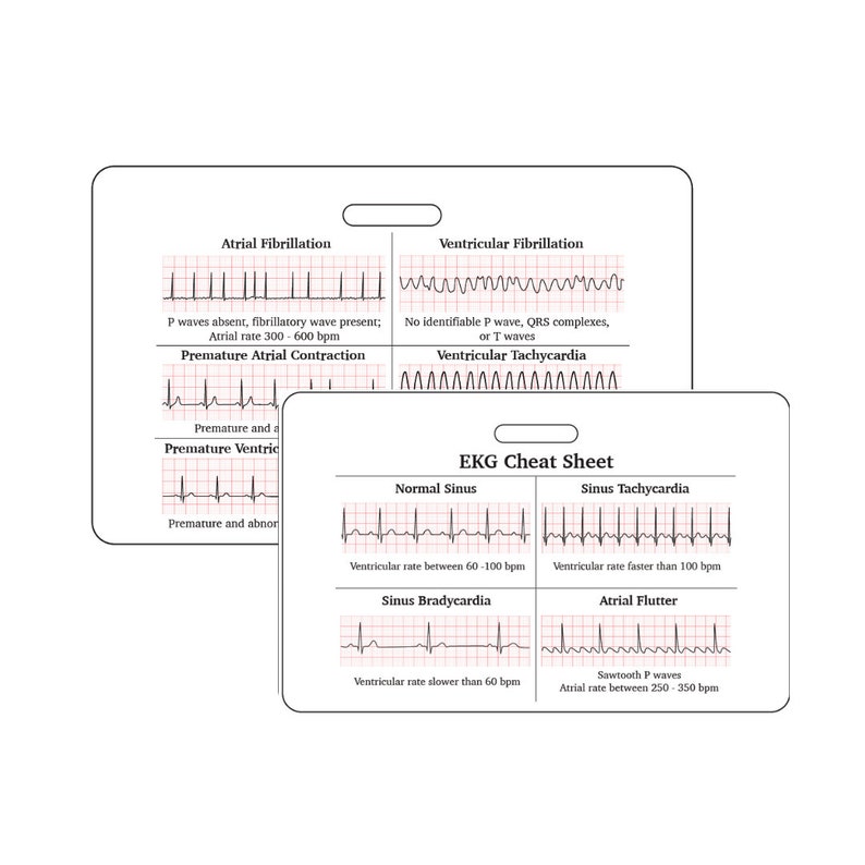 EKG Cheatsheet EKG Interpretation Reference Card - Etsy