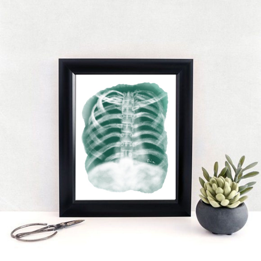 Thoracic X-ray Radiography Radiology Chiropractic Art Anatomy Art ...