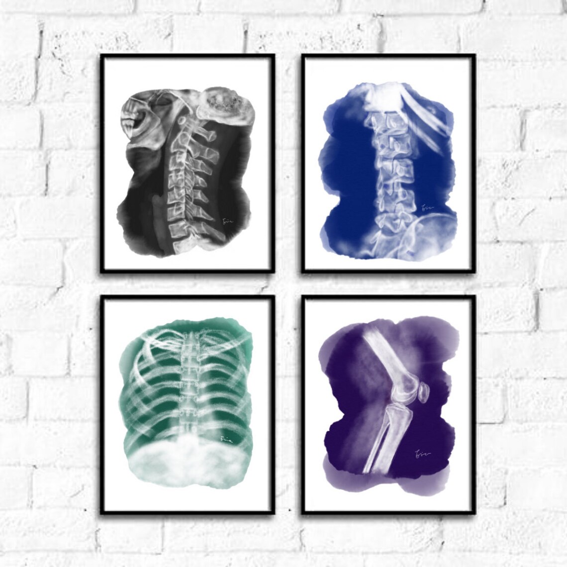 Thoracic X-ray Radiography Radiology Chiropractic Art Anatomy Art ...