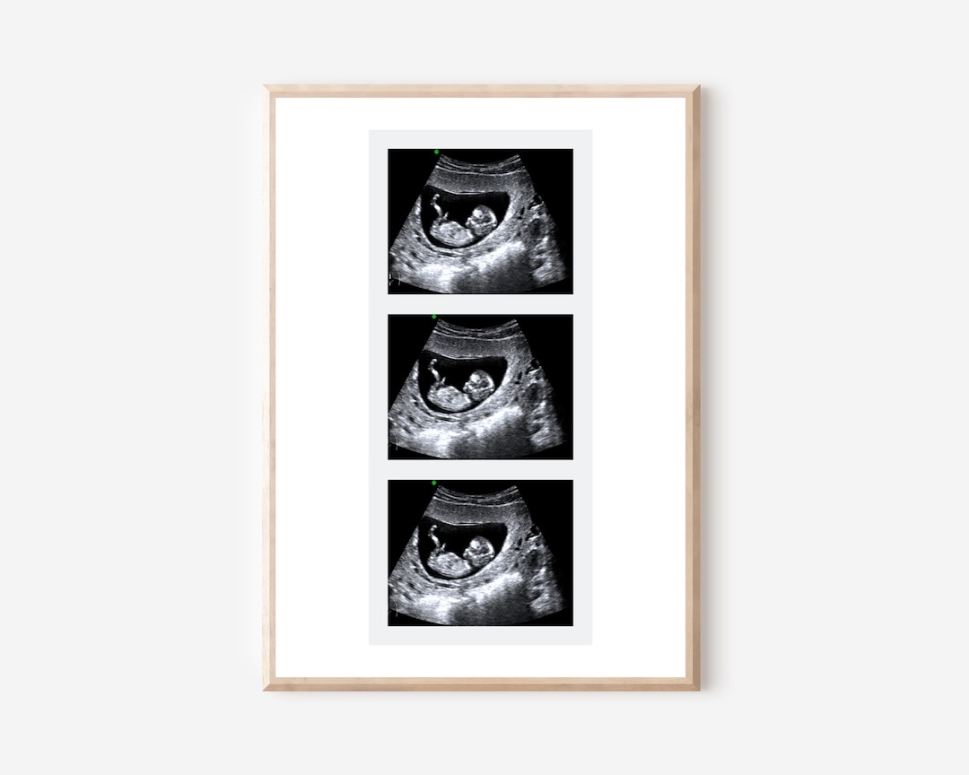 Personalised Ultrasound Strip | Photo Strip | Scan Photo Booth ...