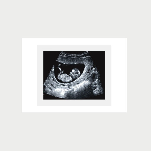 Ultrasound Canvas - Etsy