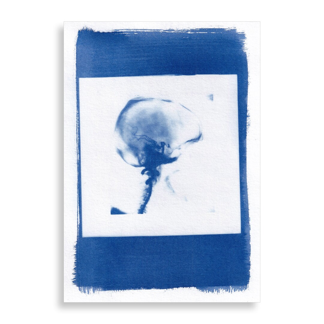 Cyanotype Skull X-ray Print - Etsy UK