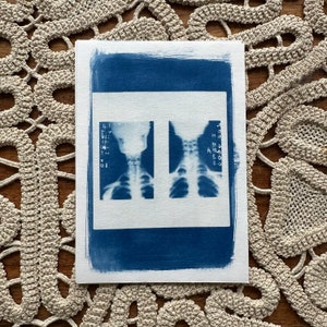 Cyanotype Skull X-ray Print - Etsy UK