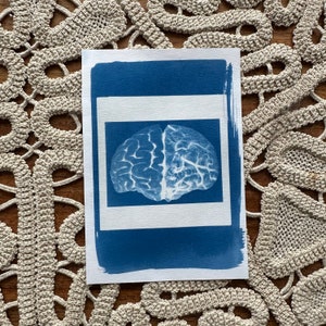 Cyanotype Skull X-ray Print - Etsy UK