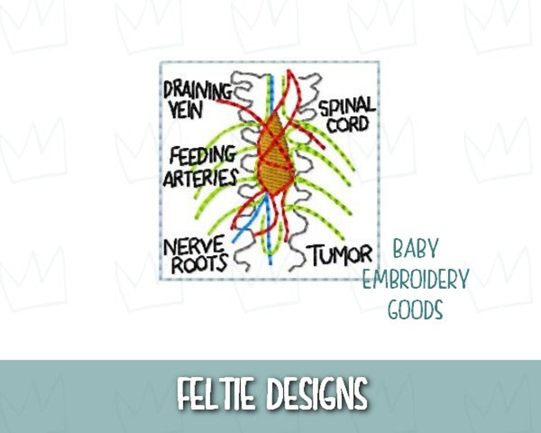 Spinal Cord 1 Sizes Feltie Machine Embroidery Design Feltie Designs ...