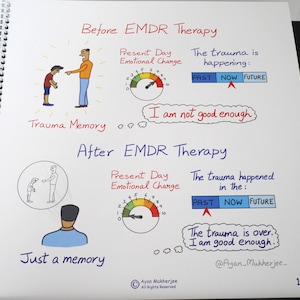 EMDR Therapy: Visual Aids Flipbook for Trauma & EMDR Therapy – Handmade ...