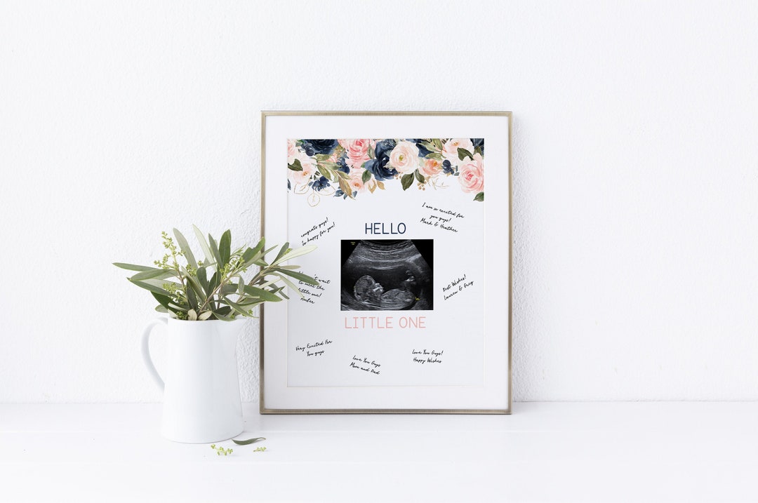 Sonogram Guest Book Sign Template, Ultrasound Photo Sign, Baby Shower ...