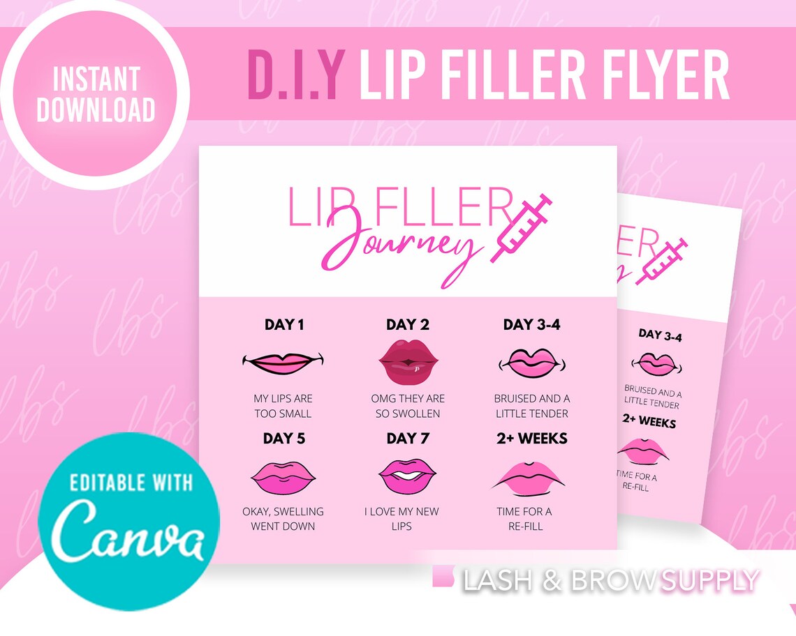 Lip Filler Flyer Dermal Filler Lips Hyaluron Pen Flyer | Etsy