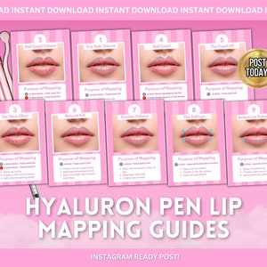 Hyaluron Pen Lip Mapping, Lip Maps, Russian Lips, Keyhole Pout, Lip ...