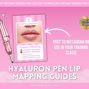 Hyaluron Pen Lip Mapping, Lip Maps, Russian Lips, Keyhole Pout, Lip ...