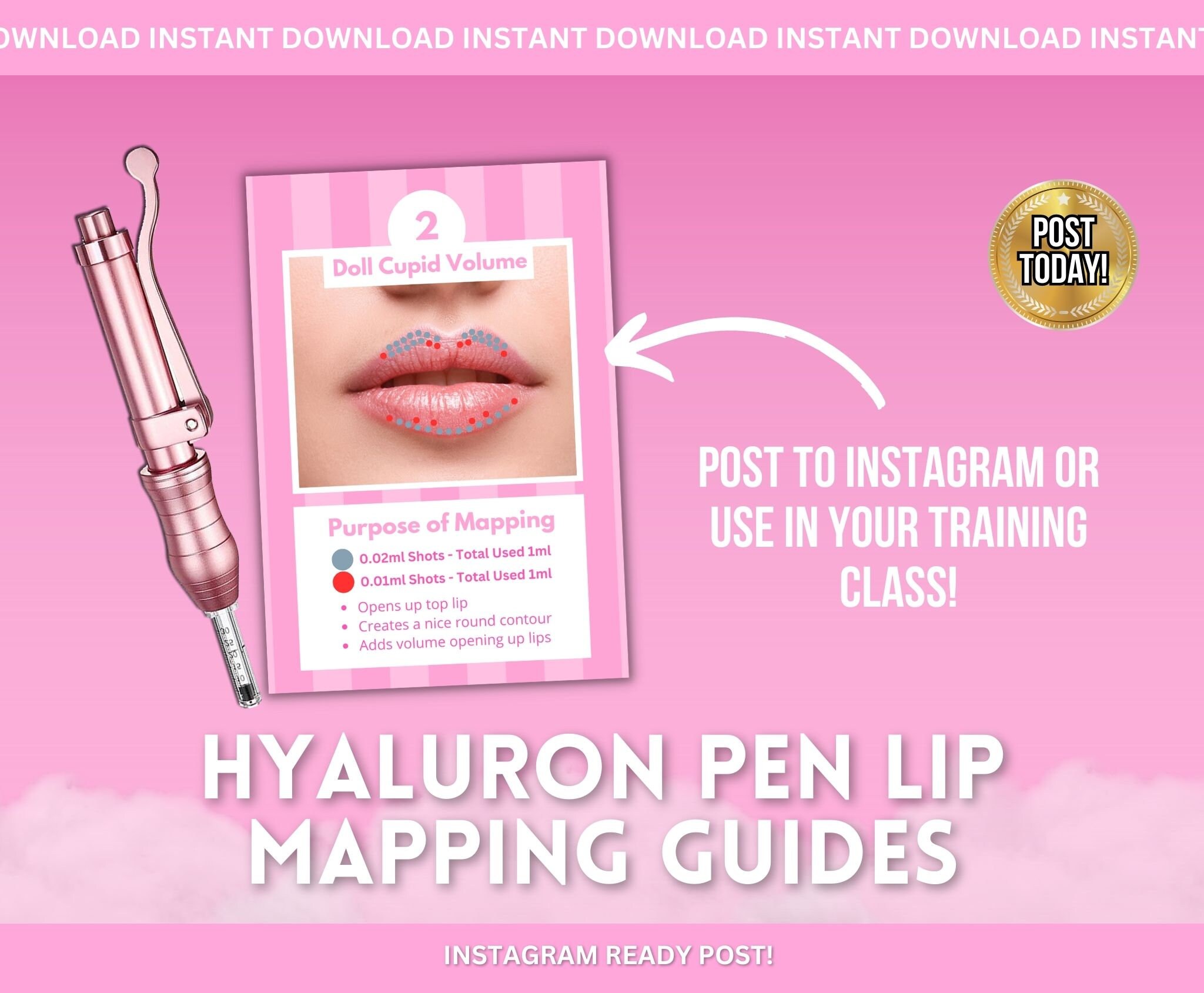 Hyaluron Pen Lip Mapping Lip Maps Russian Lips Keyhole - Etsy Israel