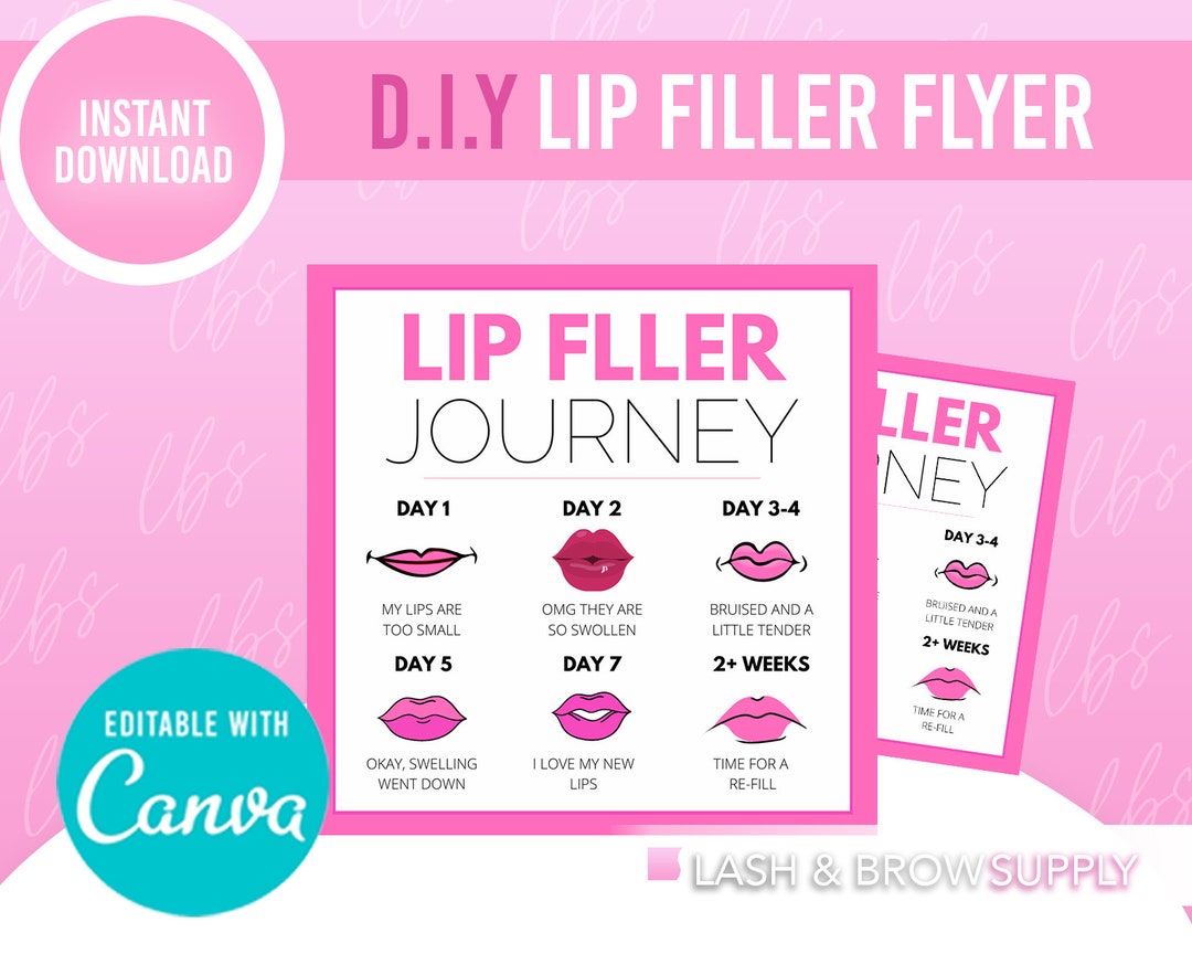 Lip Filler Flyer, Dermal Filler, Lips, Hyaluron Pen Flyer, Hyaluron Pen ...