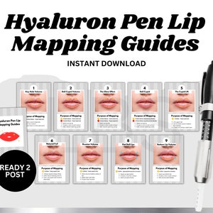 Hyaluron Pen Lip Mapping, Lip Maps, Russian Lips, Keyhole Pout, Lip ...