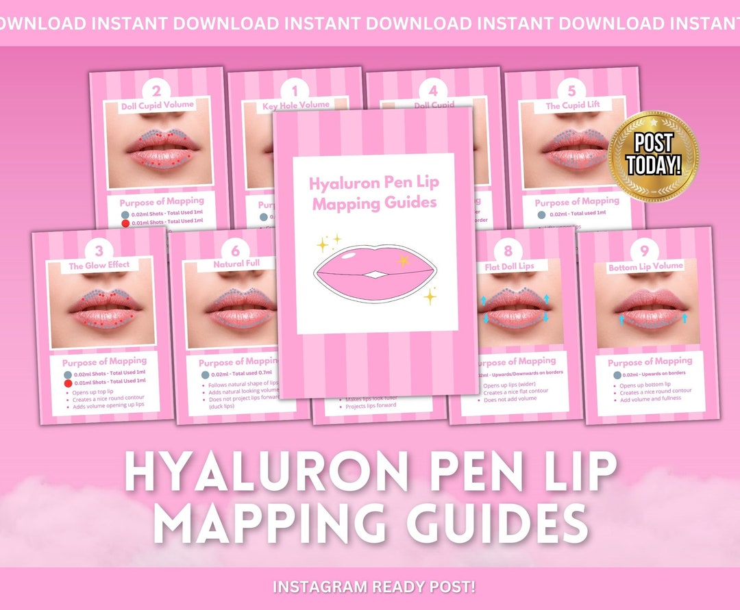 Hyaluron Pen Lip Mapping, Lip Maps, Russian Lips, Keyhole Pout, Lip ...