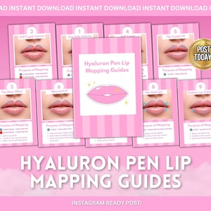 Hyaluron Pen Lip Mapping, Lip Maps, Russian Lips, Keyhole Pout, Lip ...