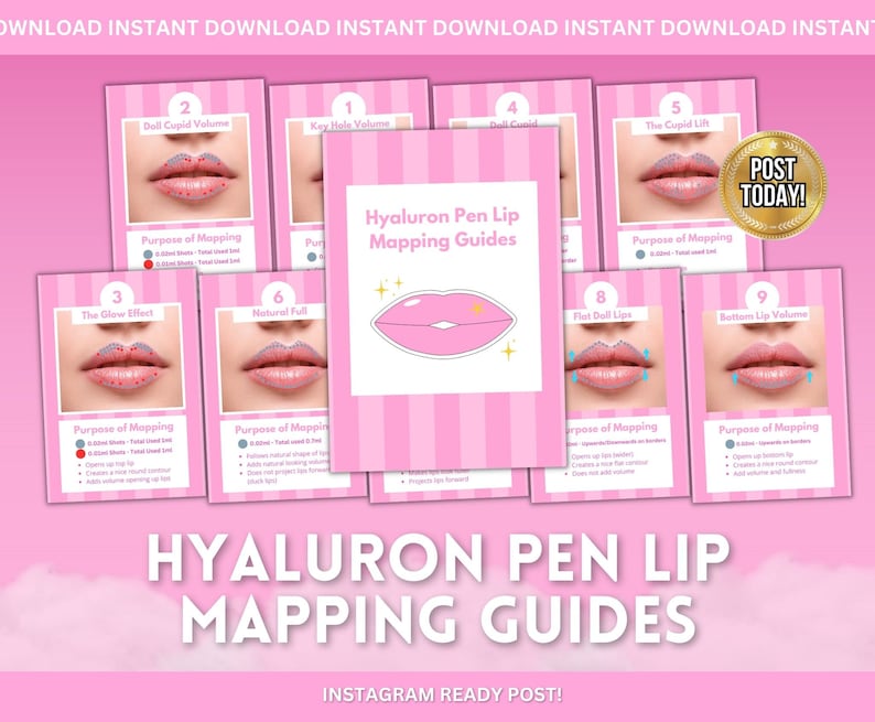 Hyaluron Pen Lip Mapping Lip Maps Russian Lips Keyhole - Etsy Israel