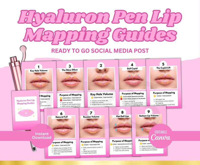 Hyaluron Pen Lip Mapping Lip Maps Russian Lips Keyhole - Etsy Ireland
