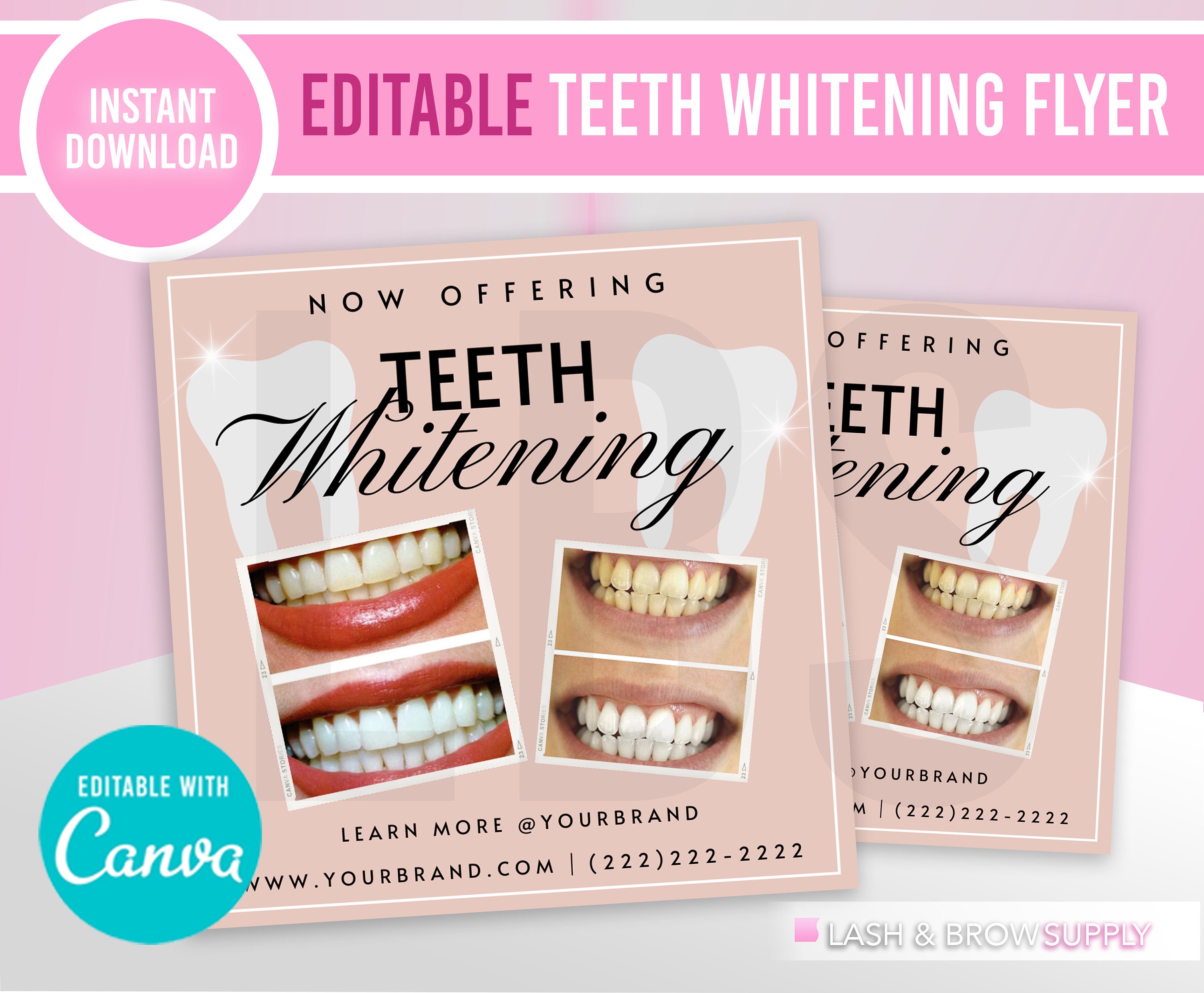 Teeth Whitening Flyer Mobile Teeth Flyer Teeth Whitening | Etsy