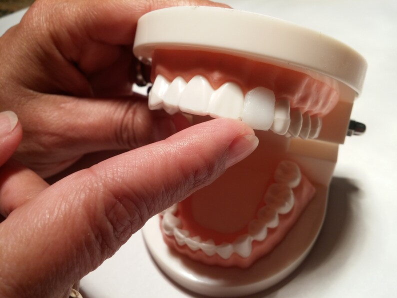 Temporary Tooth Kit x 3 Temp Dental Repair Replace Missing DIY | Etsy Temporary Tooth Kit x 3 Temp Dental Repair Replace Missing DIY | Etsy