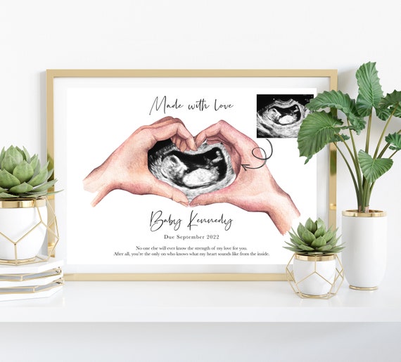 Personalised Pregnancy Scan Print Gift Baby Scan Photo Print - Etsy