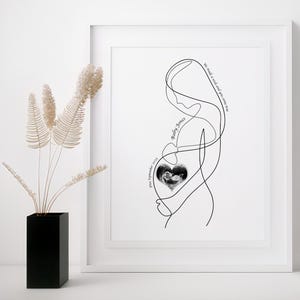 Personalised Baby Scan Print, Ultrasound Sonogram Art, Baby Scan ...