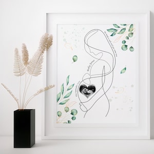 Personalised Baby Scan Print, Ultrasound Sonogram Art, Baby Scan ...