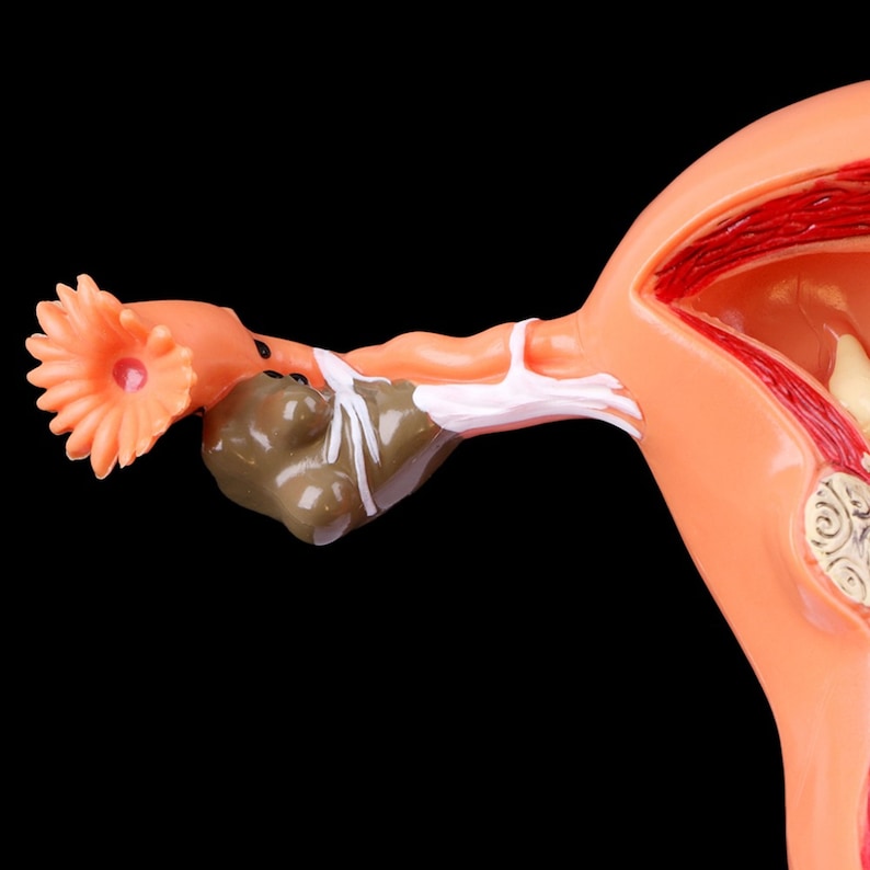 Pathological Uterus Ovary Anatomical Model Anatomy Cross | Etsy Pathological Uterus Ovary Anatomical Model Anatomy Cross | Etsy