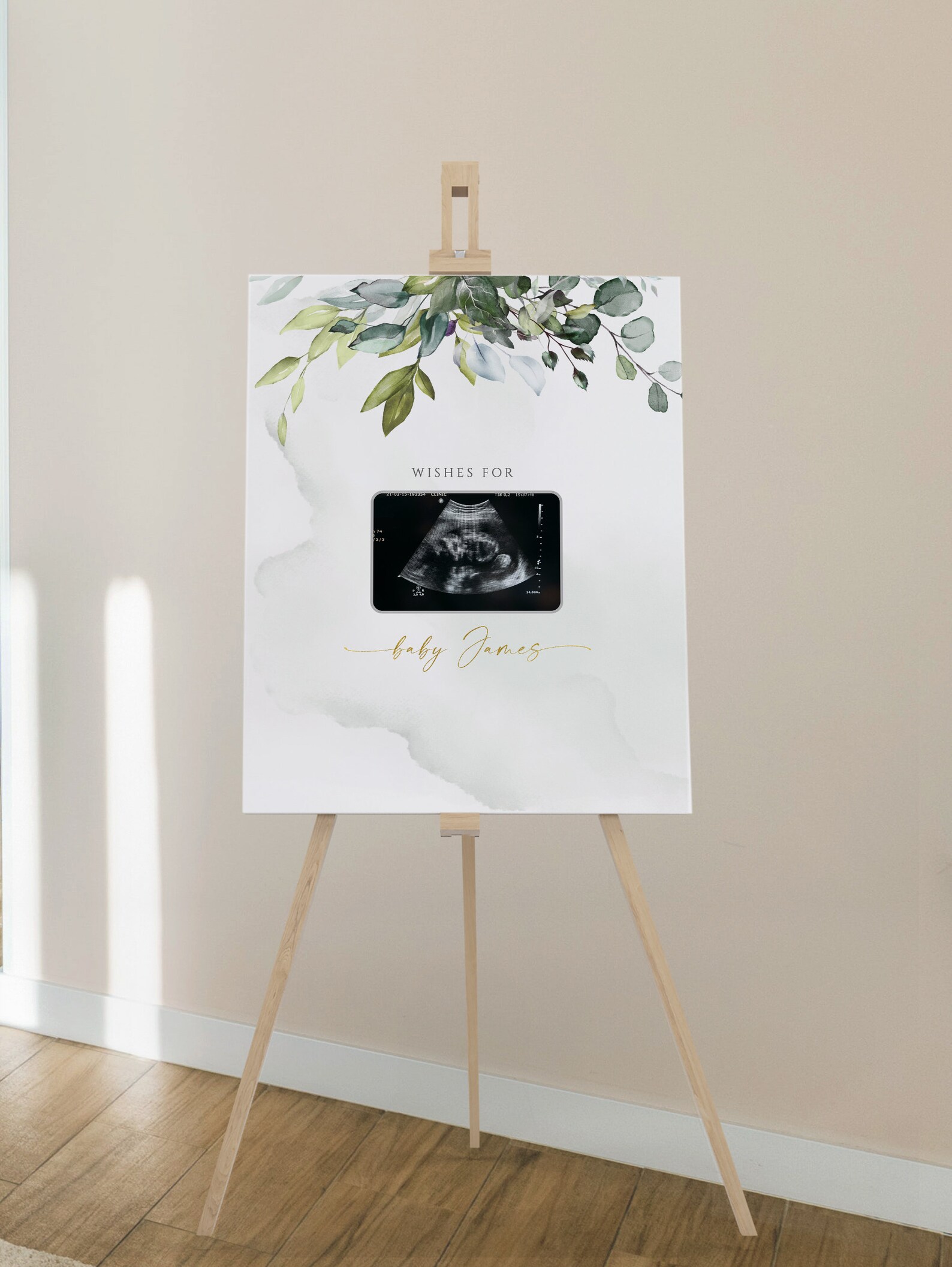 Printable Sonogram Ultrasound Guestbook Sonogram Photo Sign - Etsy