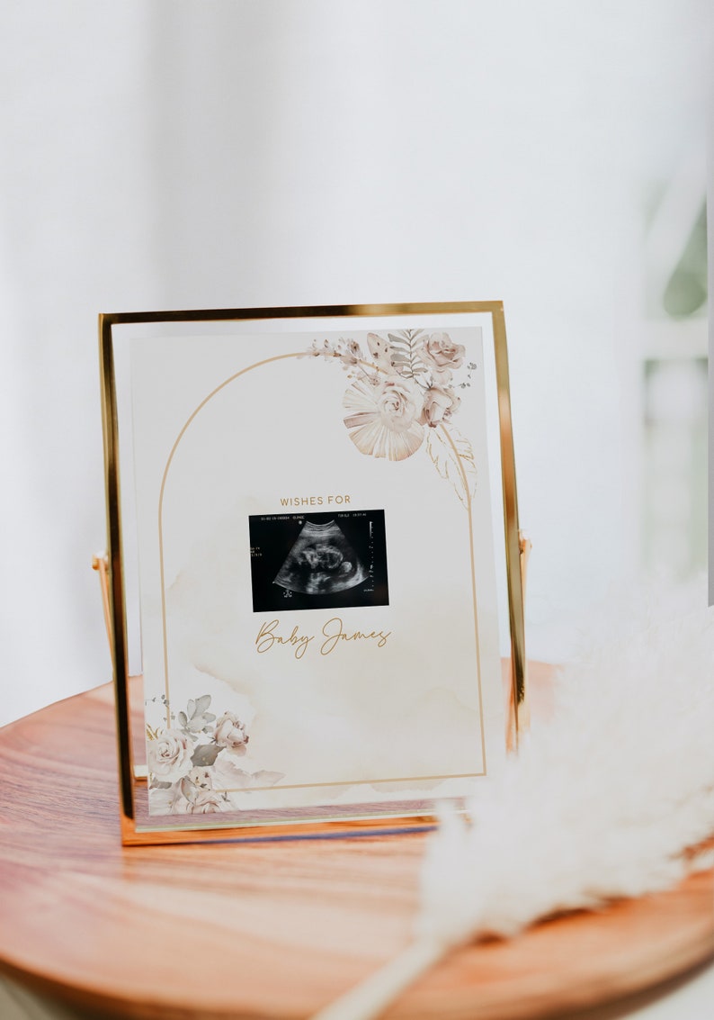 Printable Sonogram Ultrasound Guestbook Sonogram Photo Sign - Etsy