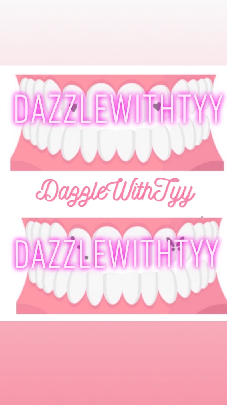 25 Tooth Gem Mapping Ideas- Edition 3 | Easy to Intricate Tooth Gem ...