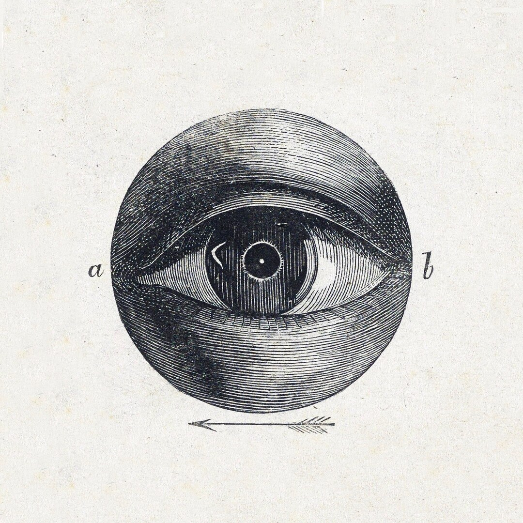 ISAAC WEISSENBRUCH Human Eye With Abnormality Anatomy Original in ...