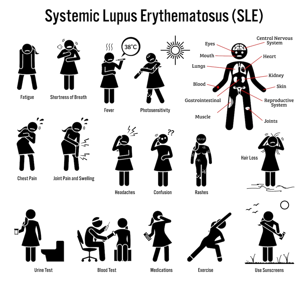 Systemic Lupus Erythematosus SLE Autoimmune Disease Sign Symptom ...