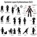 Systemic Lupus Erythematosus SLE Autoimmune Disease Sign Symptom ...