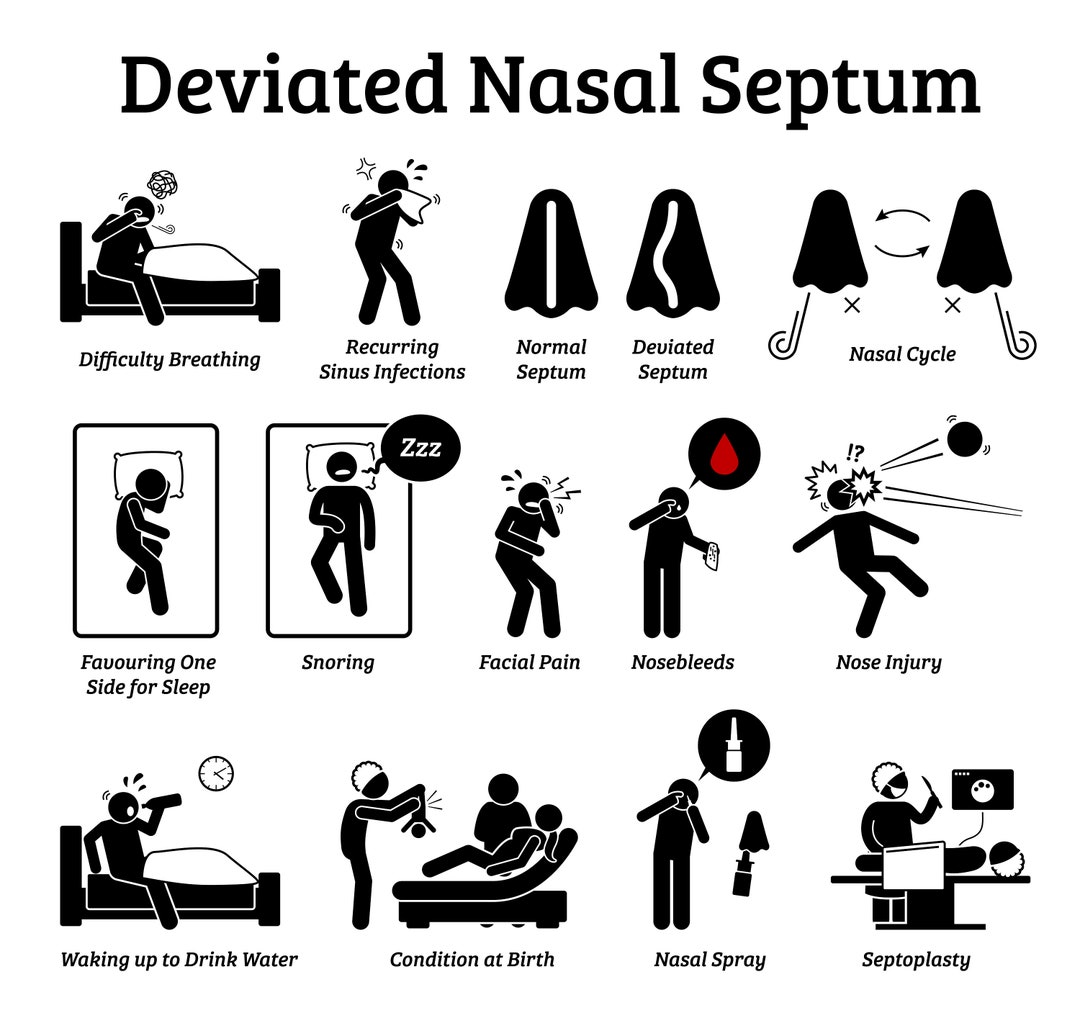 Deviated Nasal Septum Signs Symptoms Nose Problem Medical Condition ...